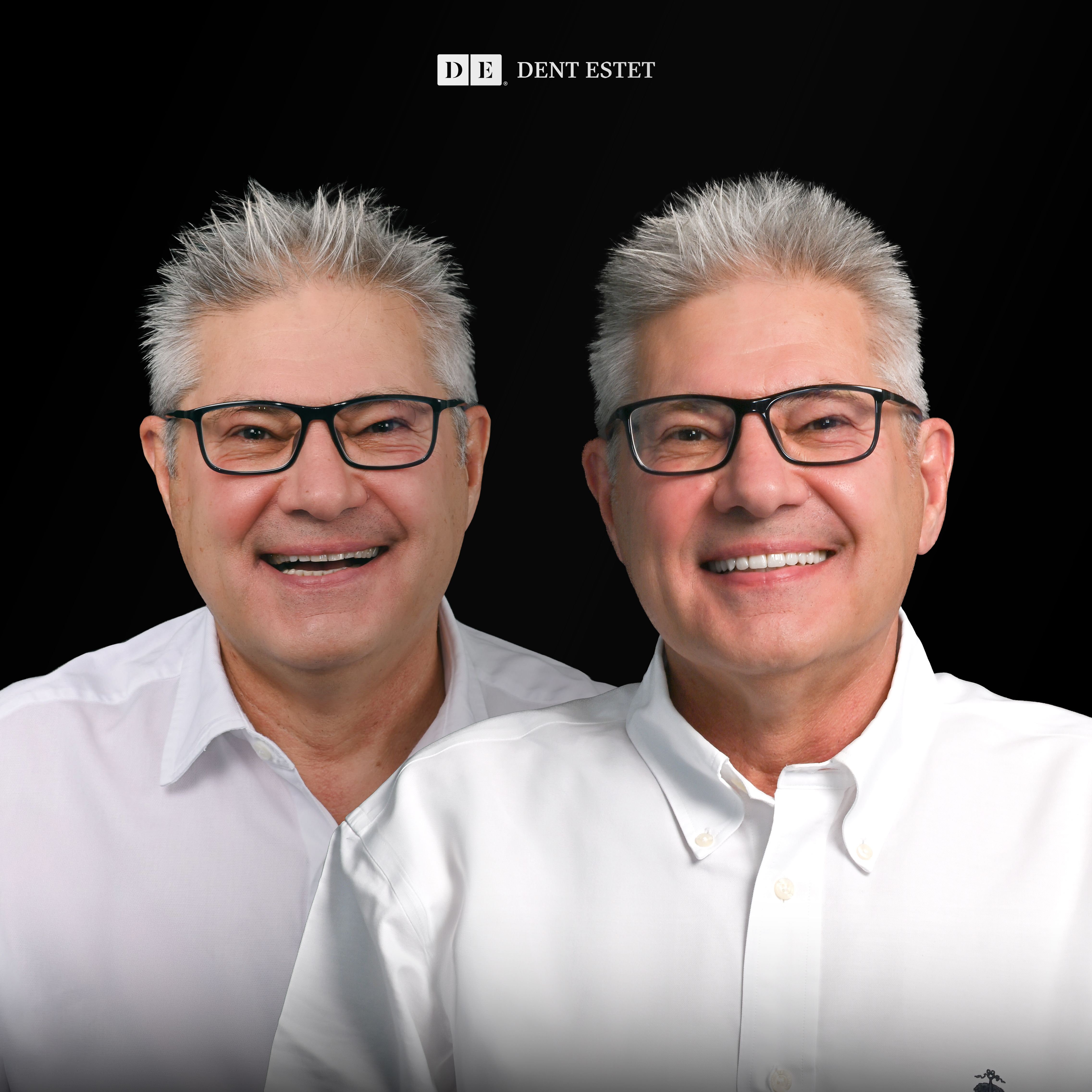 Coroane si fatete dentare PREMIUM | DENT ESTET